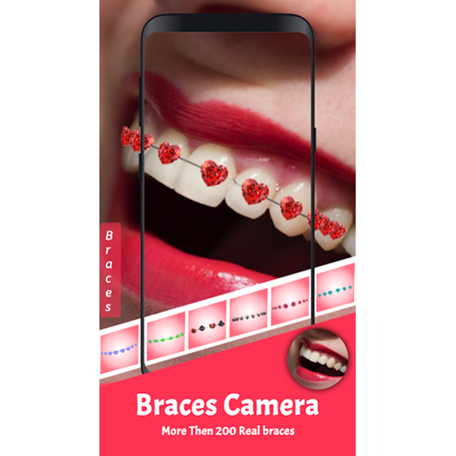 10 Best Remove Braces Apps For Android And Ios Tutorial Homiesfoto